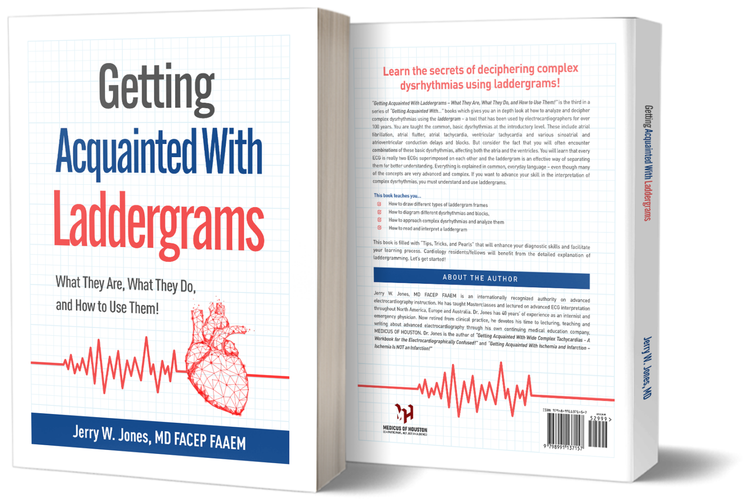 ECG Interpretation | Basic and Advanced ECG Courses | Medicus of Houston